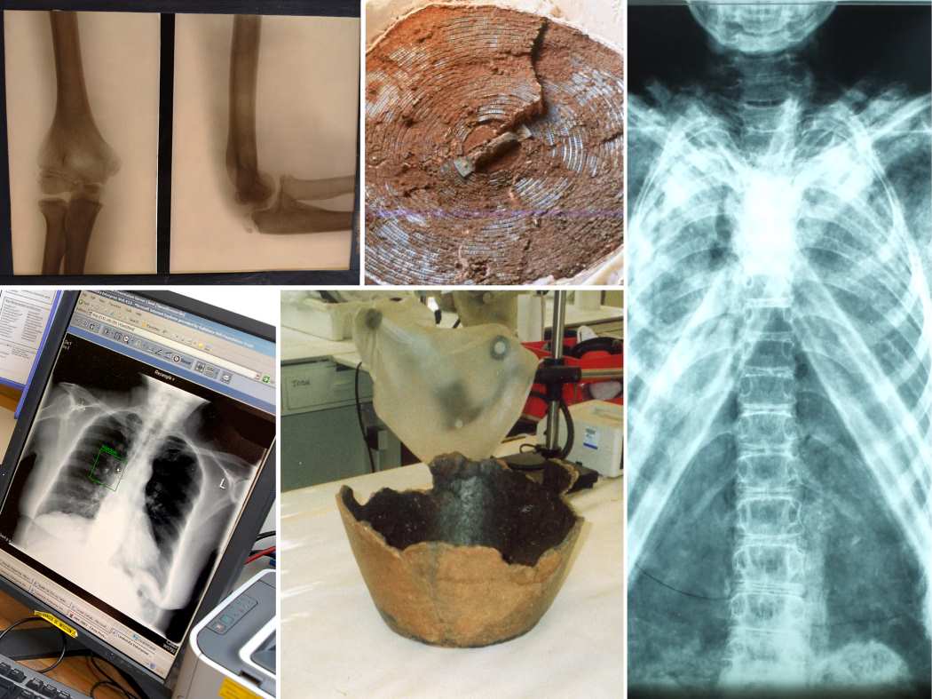 History lunch – Radiology mummies and more Salisbury Healthcare History